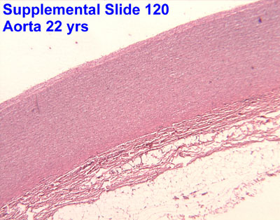 Aorta Slide Labeled